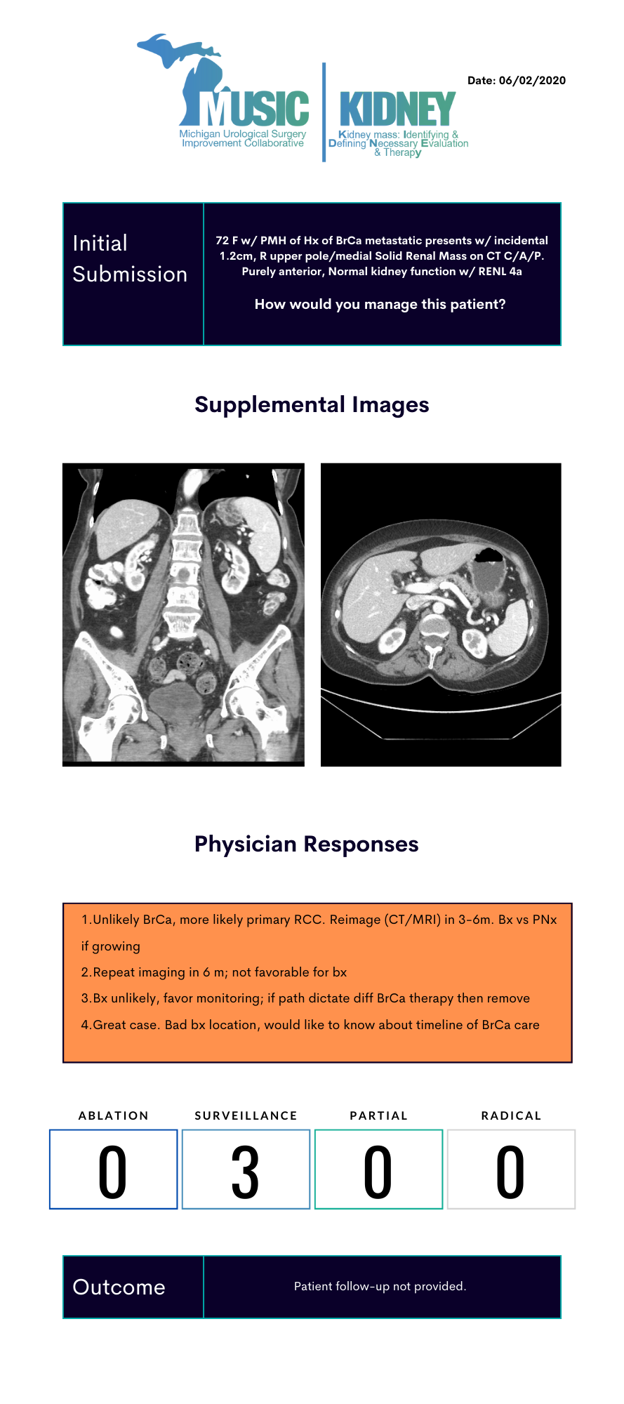 Virtual Tumor Board - Michigan Urological Surgery Improvement ...